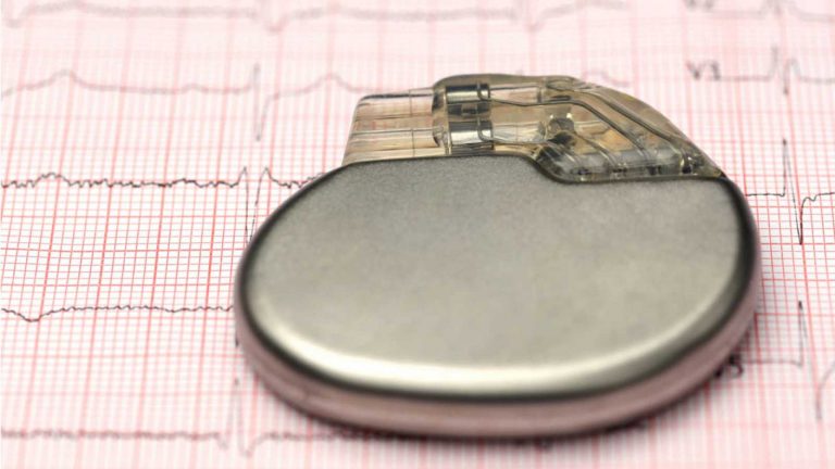 Implante de marcapasos temporal y definitivo – Dr. Freddy Loinaz